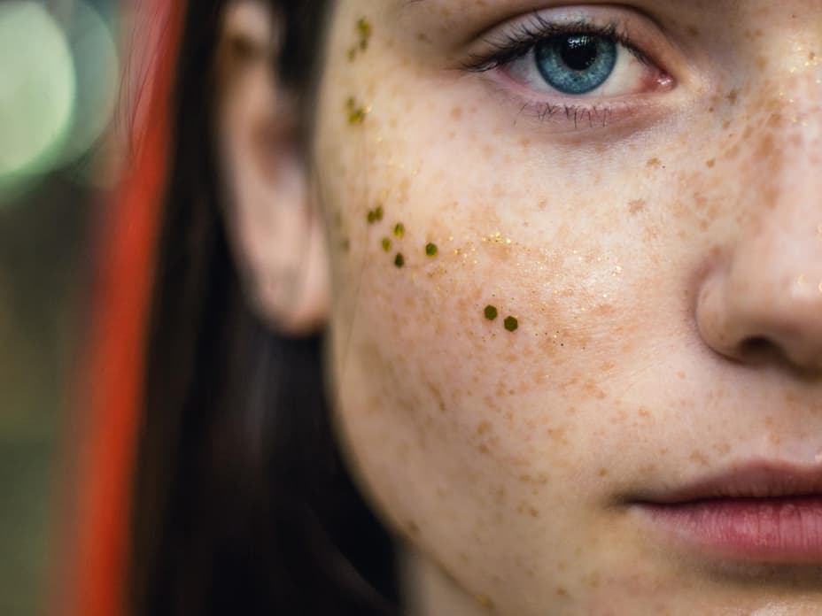 Pickel im Gesicht: Das verrät die Lage des Pickels über deine ...